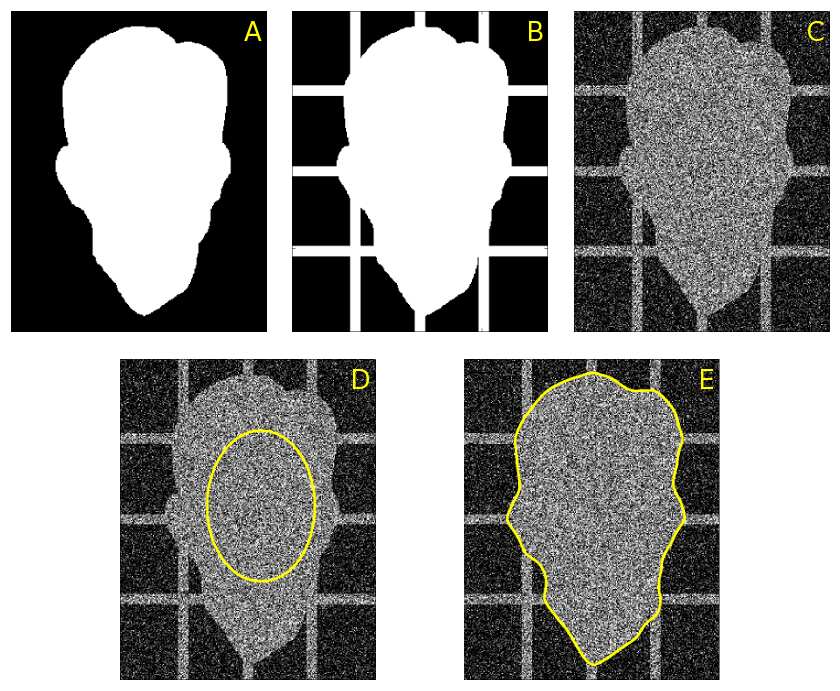 Image Segmentation Using Weak Shape Priors | DeepAI