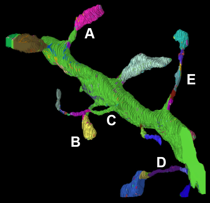 Large Scale Automatic Reconstruction Of Neuronal Processes From
