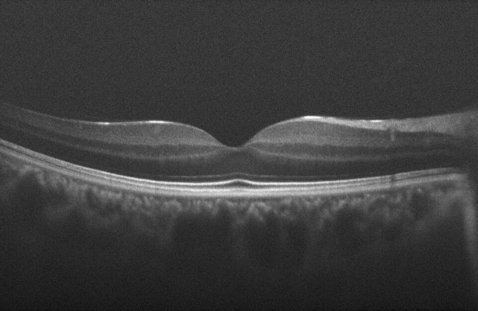 Sparse And Low Rank Decomposition Based Batch Image Alignment for ...
