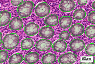 Gland Segmentation in Colon Histology Images: The GlaS Challenge ...