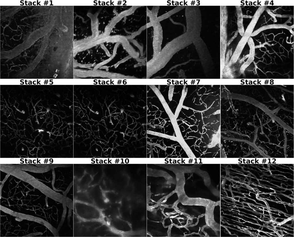 Deep Learning Convolutional Networks For Multiphoton Microscopy