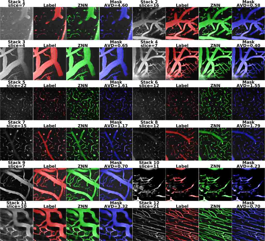 Deep Learning Convolutional Networks For Multiphoton Microscopy