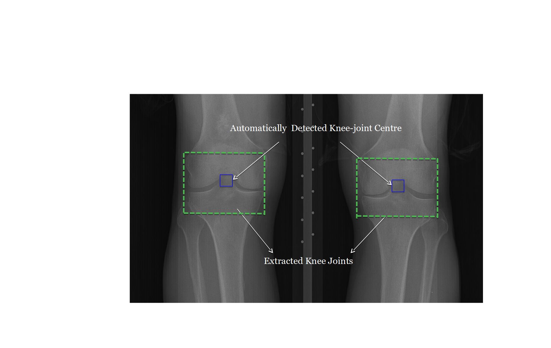 Quantifying Radiographic Knee Osteoarthritis Severity Using Deep