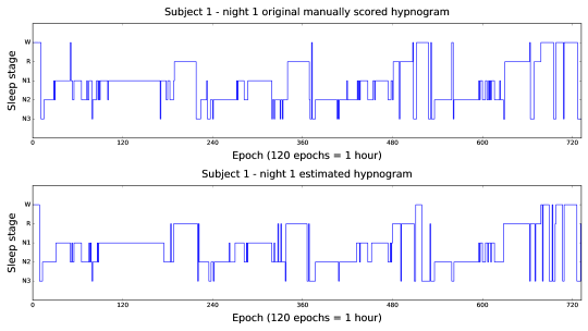 Automatic Sleep Stage Scoring with Single-Channel EEG Using Convolutional Neural Networks | DeepAI
