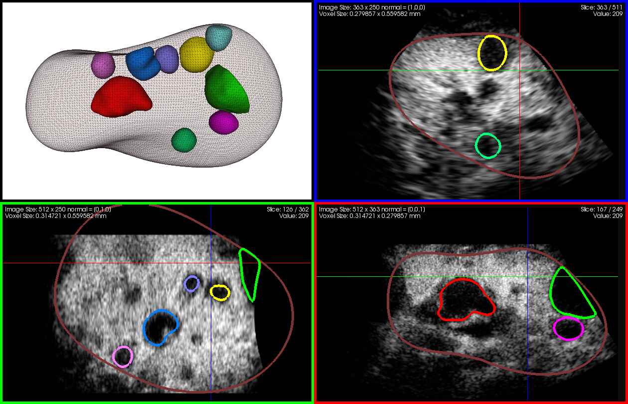 3D Ultrasound image segmentation: A Survey | DeepAI