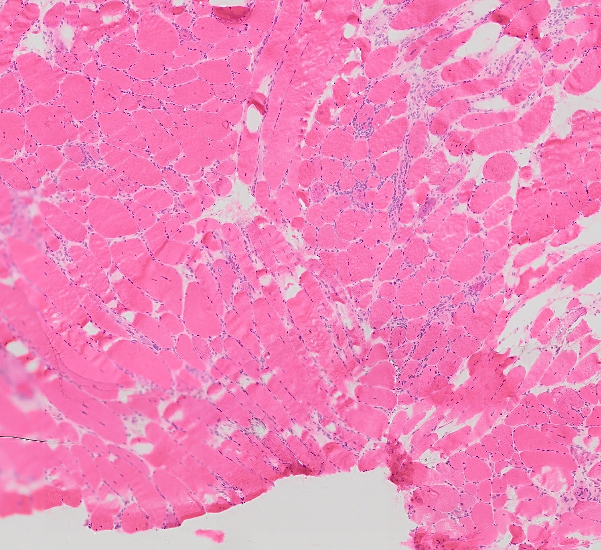 Microscopic Muscle Image Enhancement | DeepAI