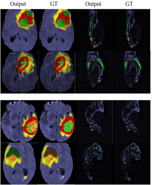 CNN-based Segmentation of Medical Imaging Data | DeepAI