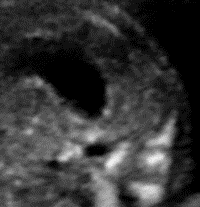 Automatic Estimation of Fetal Abdominal Circumference from Ultrasound ...