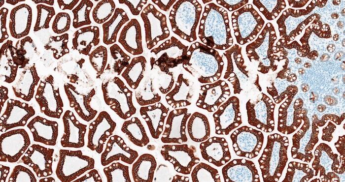 Classification and Retrieval of Digital Pathology Scans: A New Dataset ...