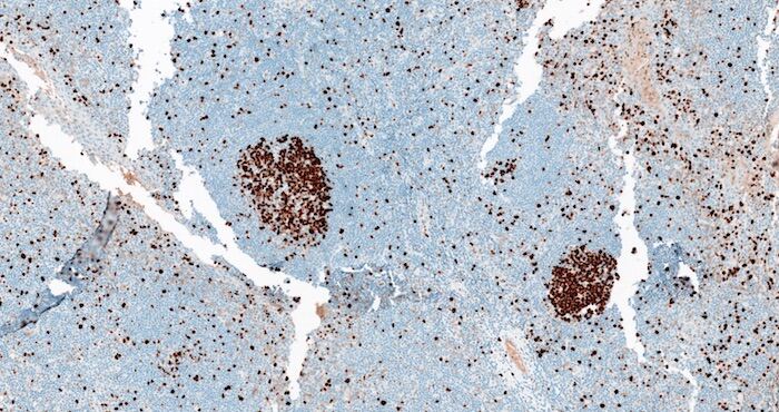 Classification and Retrieval of Digital Pathology Scans: A New Dataset ...