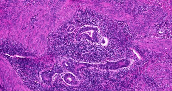 Classification and Retrieval of Digital Pathology Scans: A New Dataset ...