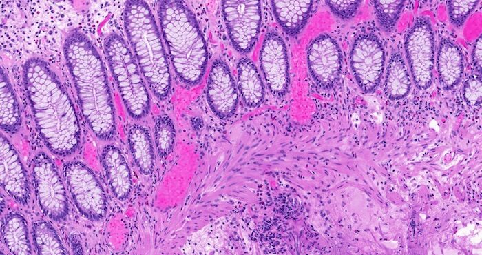 Classification and Retrieval of Digital Pathology Scans: A New Dataset ...