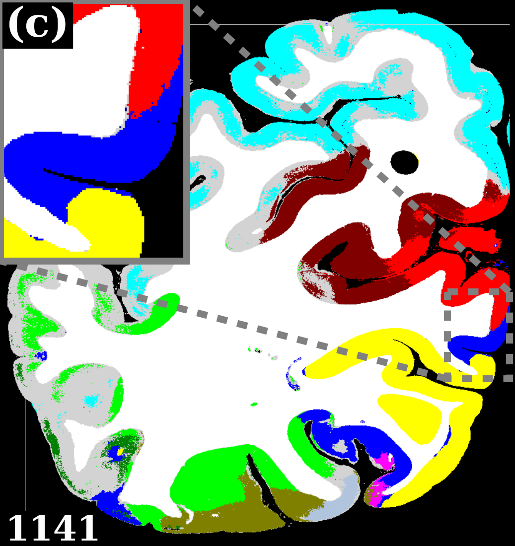 Parcellation of Visual Cortex on high-resolution histological Brain Sections using Convolutional ...