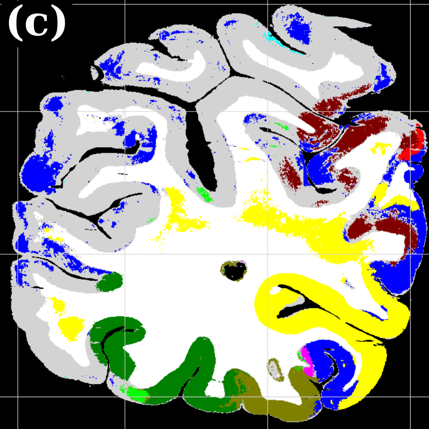 Parcellation of Visual Cortex on high-resolution histological Brain Sections using Convolutional ...