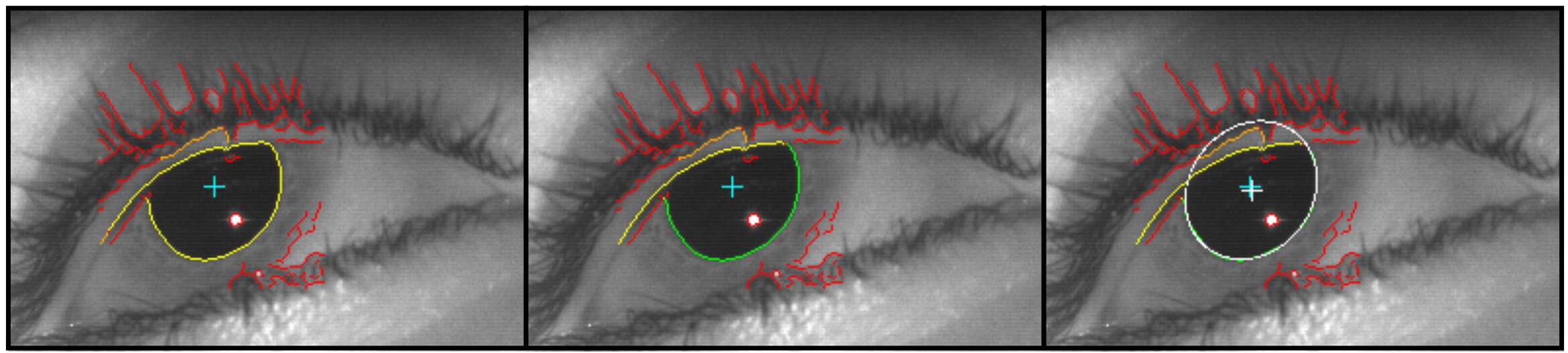Robust Video Based Eye Tracking Using Recursive Estimation Of Pupil