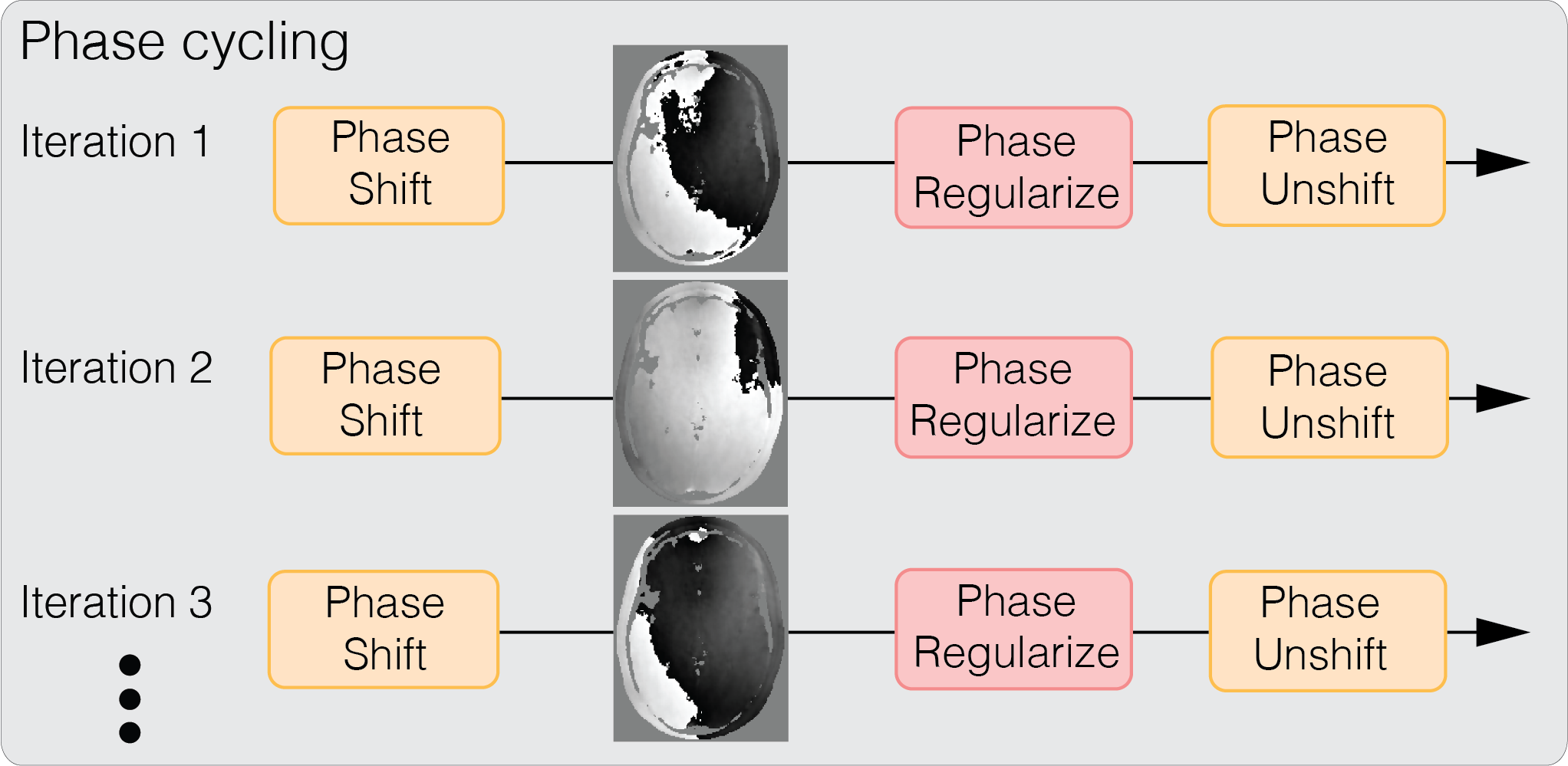 General Phase Regularized Reconstruction using Phase Cycling | DeepAI