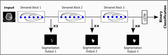 Radnet Radiologist Level Accuracy Using Deep Learning For Hemorrhage
