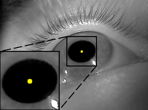 Pure Robust Pupil Detection For Real Time Pervasive Eye Tracking Deepai