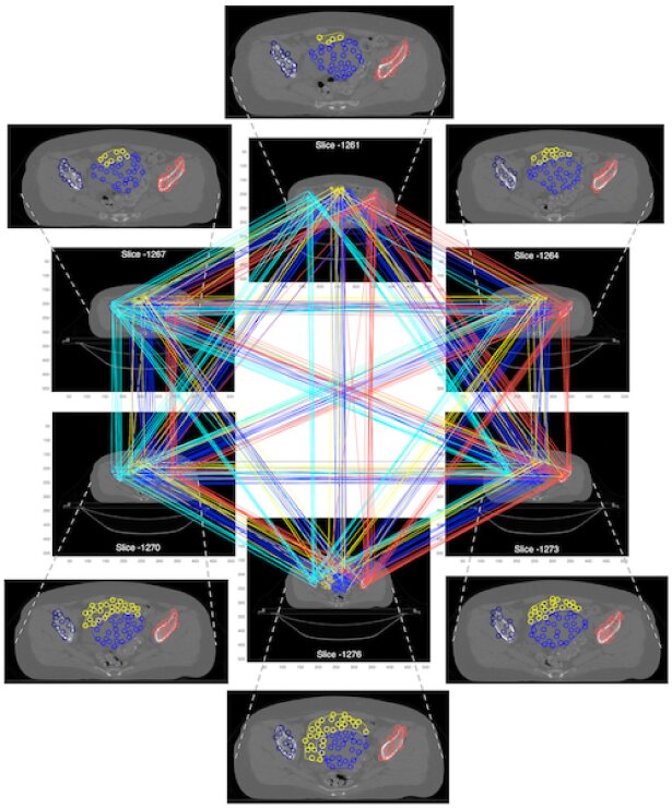 Scalable Label Propagation For Multi Relational Learning On Tensor Product Graph Deepai 