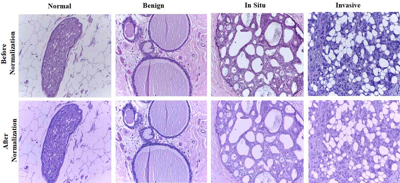 Classification of breast cancer histology images using transfer ...