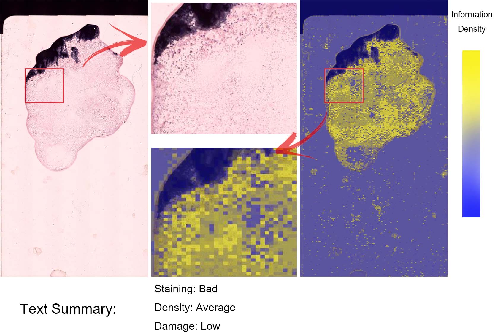 SlideNet: Fast and Accurate Slide Quality Assessment Based on Deep ...