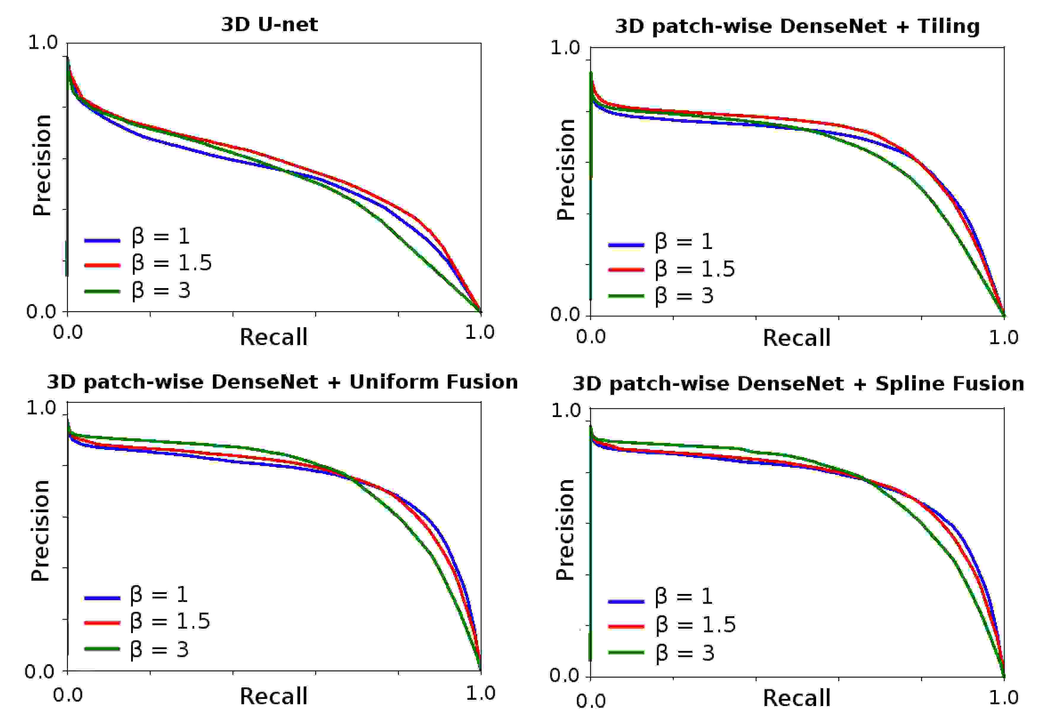 Tversky as a Loss Function for Highly Unbalanced Image Segmentation using 3D Fully Convolutional ...