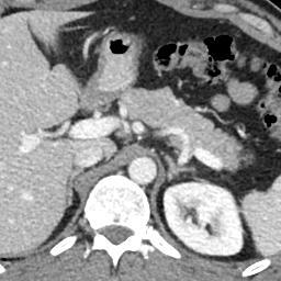 Pancreas Segmentation in CT and MRI Images via Domain Specific Network ...