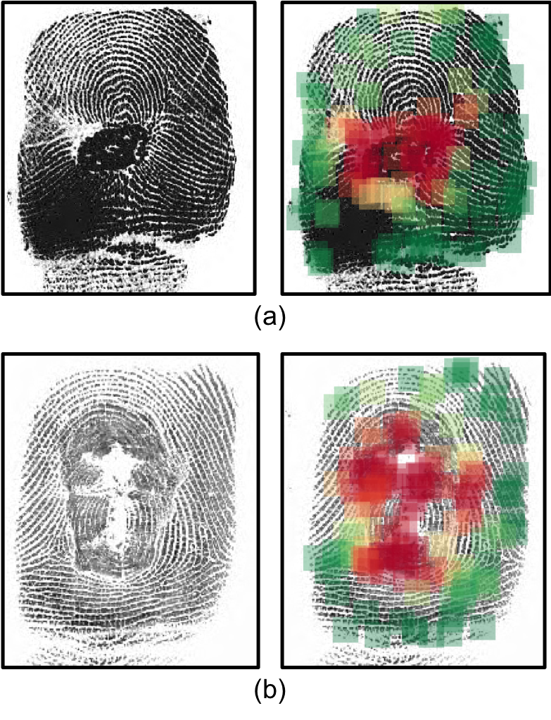 Altered Fingerprints: Detection and Localization | DeepAI