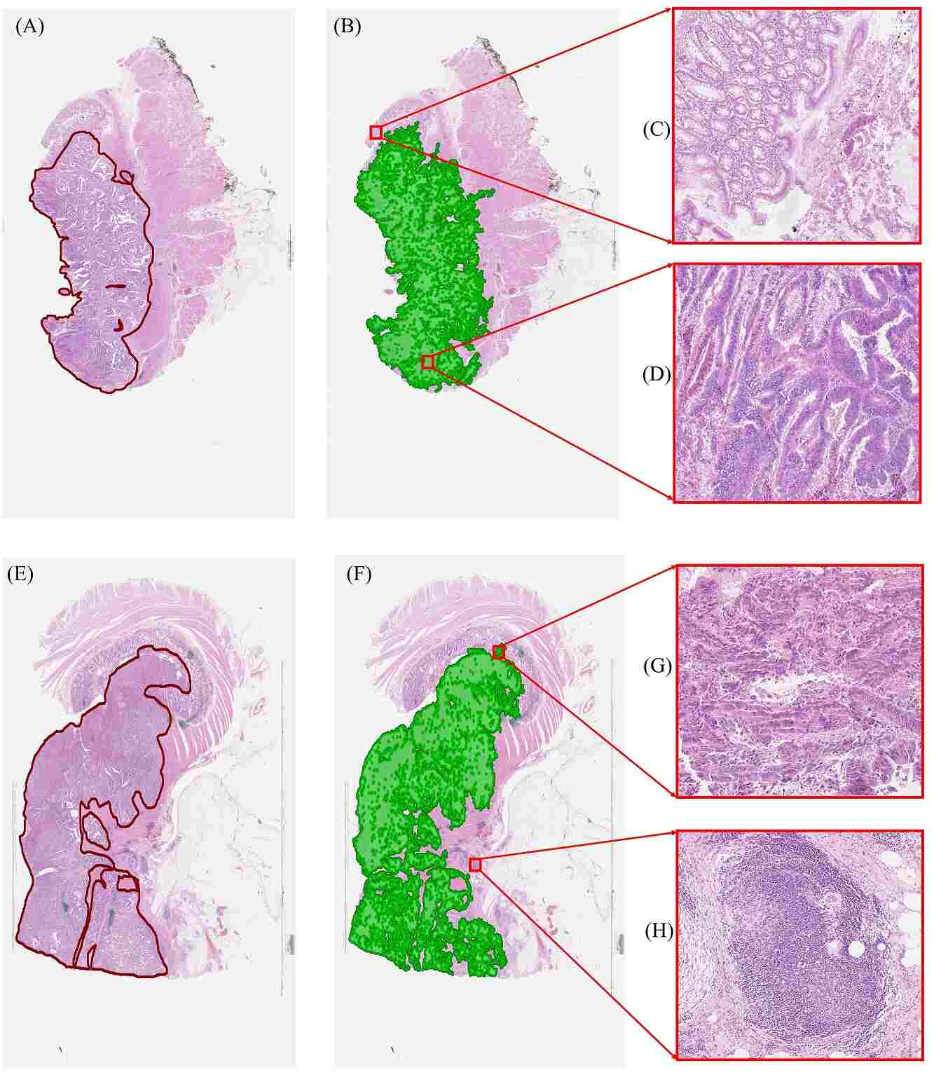 Fast and Accurate Tumor Segmentation of Histology Images using Persistent Homology and Deep ...
