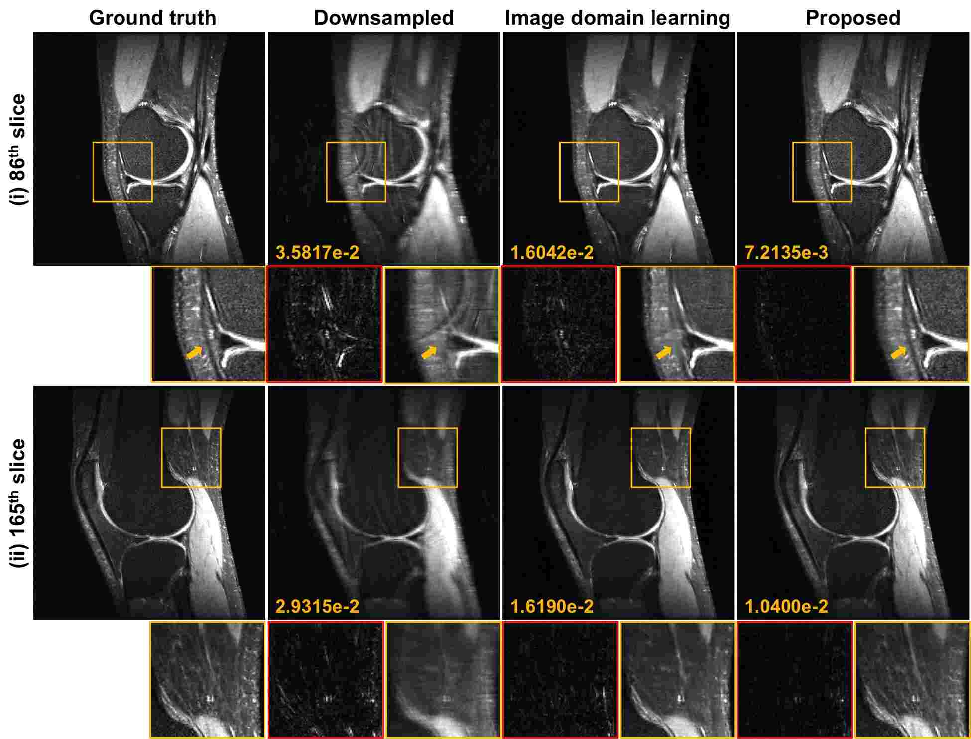 k-Space Deep Learning for Accelerated MRI | DeepAI