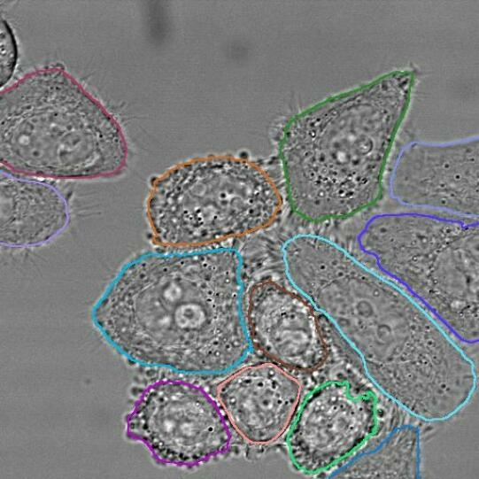 Microscopy Cell Segmentation Via Convolutional Lstm Networks Deepai 