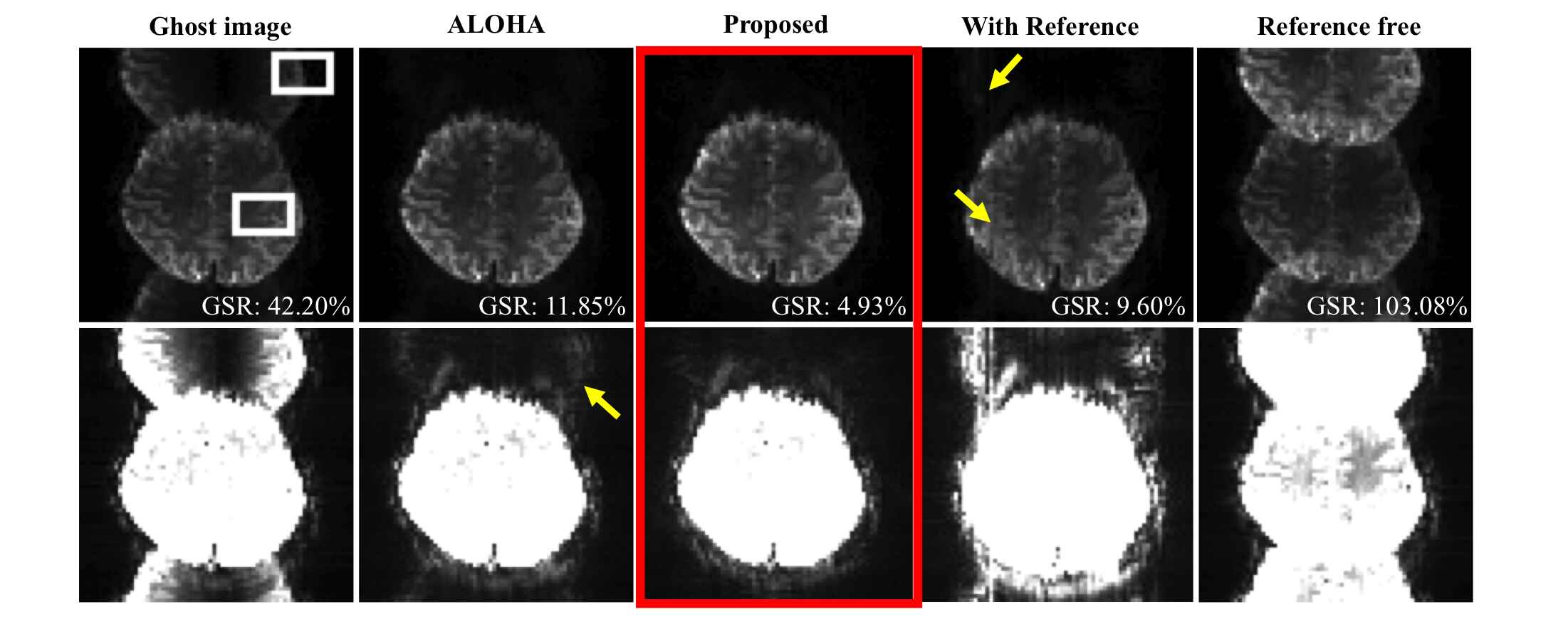 k-Space Deep Learning for Reference-free EPI Ghost Correction | DeepAI