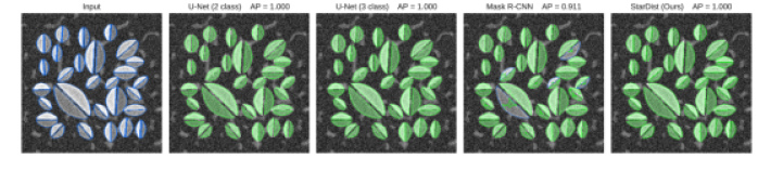 Cell Detection With Star Convex Polygons Deepai