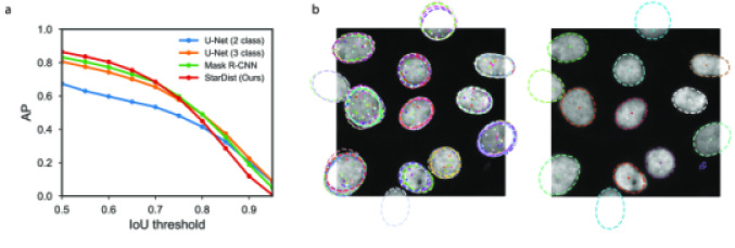 Cell Detection With Star Convex Polygons Deepai 