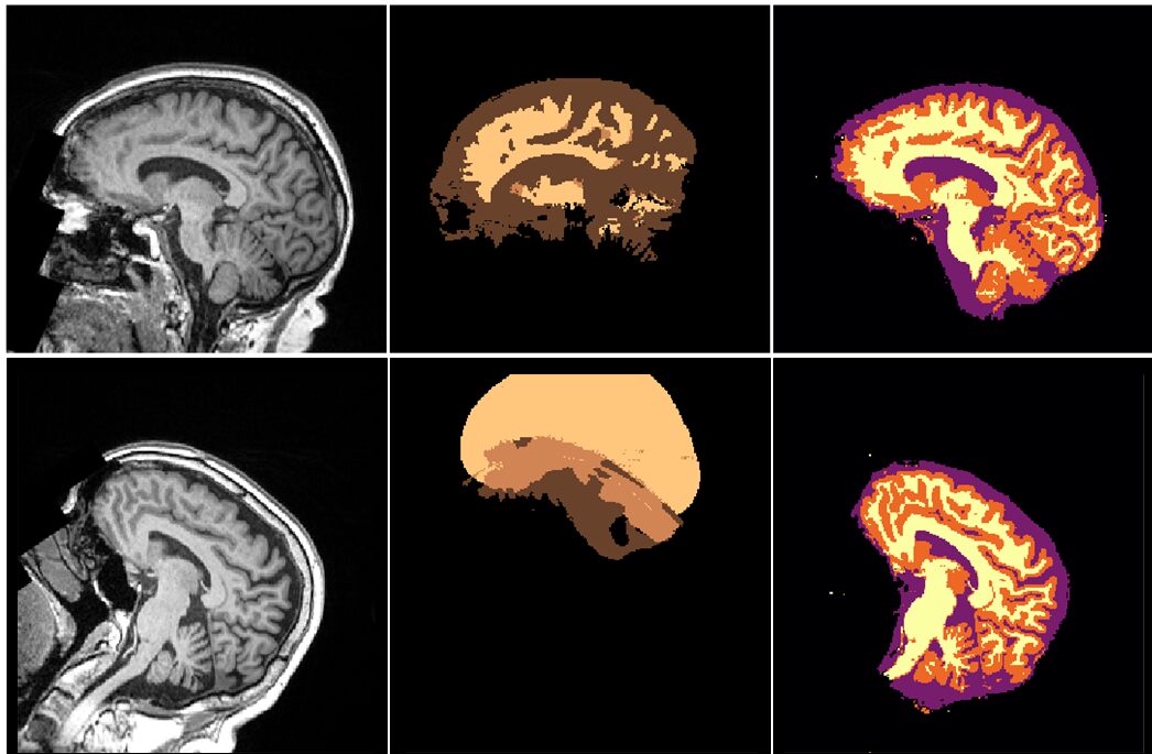 NeuroNet: Fast and Robust Reproduction of Multiple Brain Image Segmentation Pipelines | DeepAI