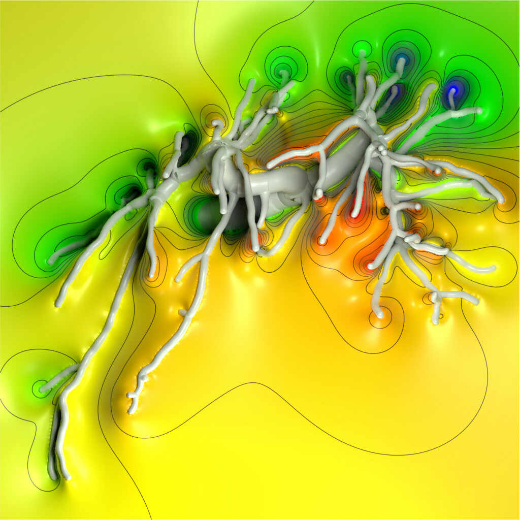 Void Space Surfaces to Convey Depth in Vessel Visualizations | DeepAI