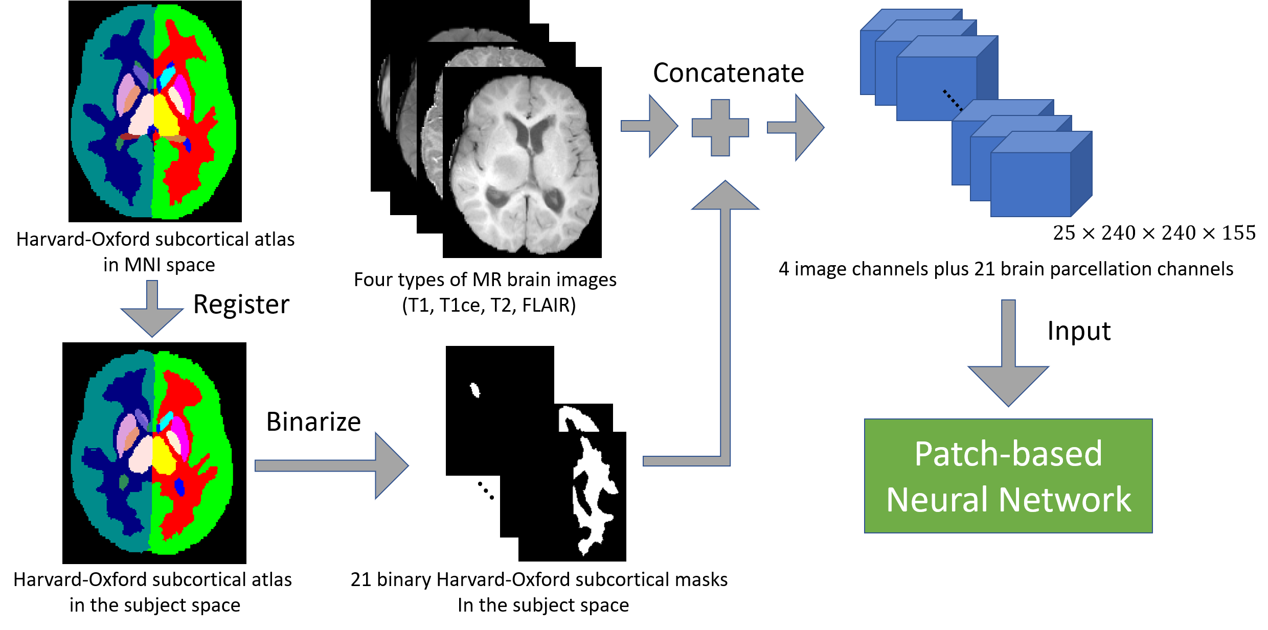 Brain Tumor Segmentation And Tractographic Feature Extraction From