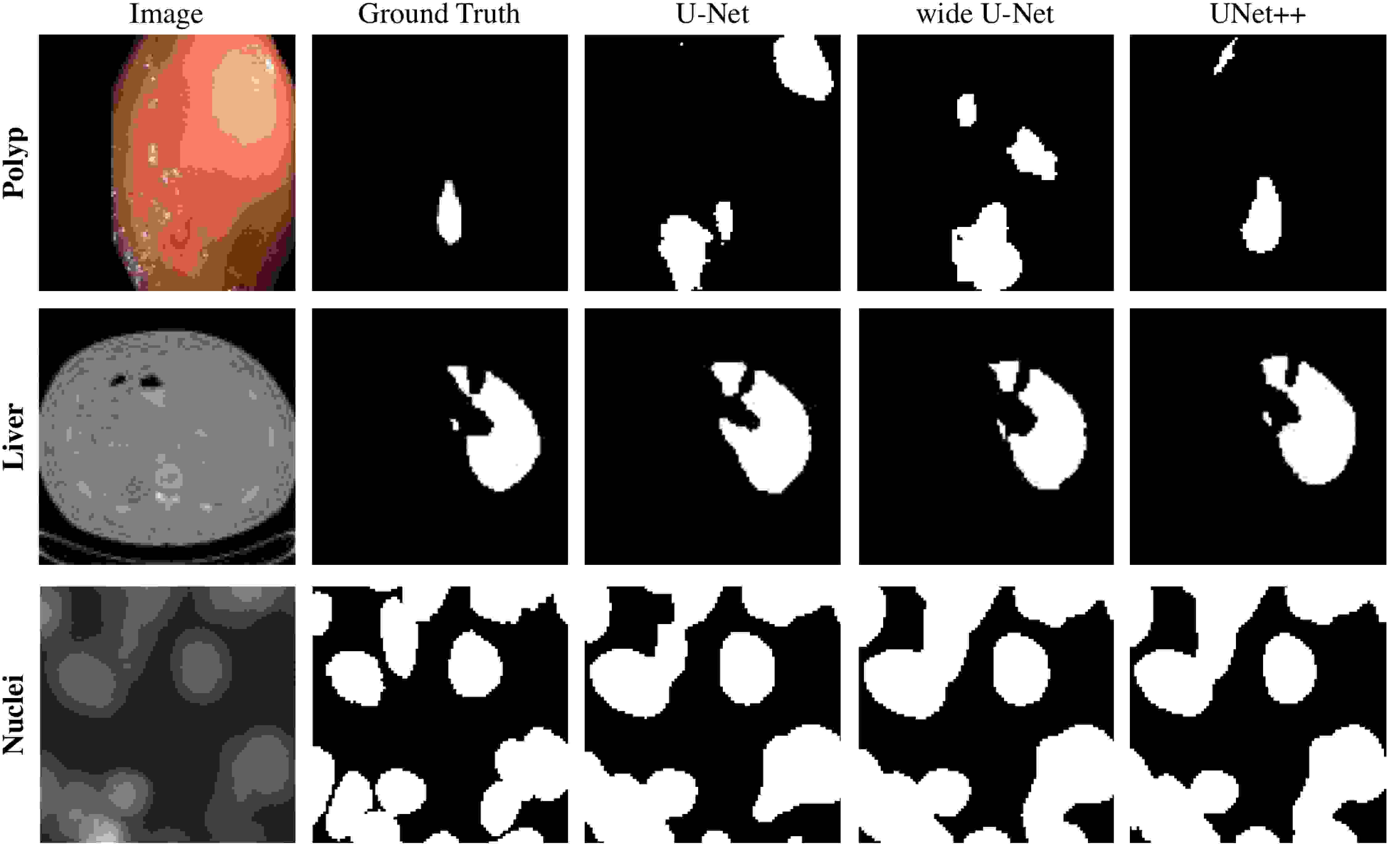 UNet++: A Nested U-Net Architecture for Medical Image Segmentation | DeepAI