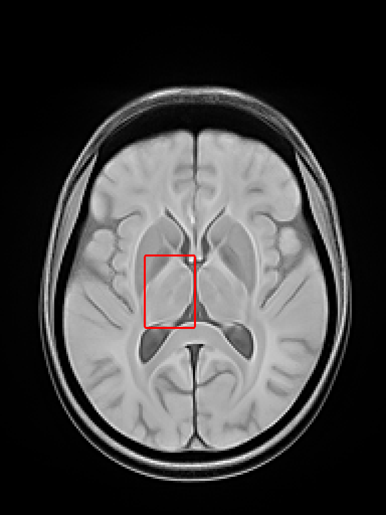 A multi-contrast MRI approach to thalamus segmentation | DeepAI