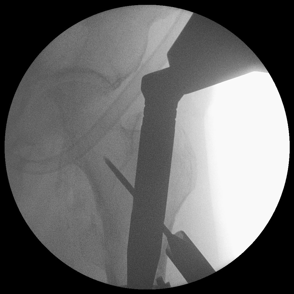 Deep Morphing: Detecting bone structures in fluoroscopic X-ray images ...