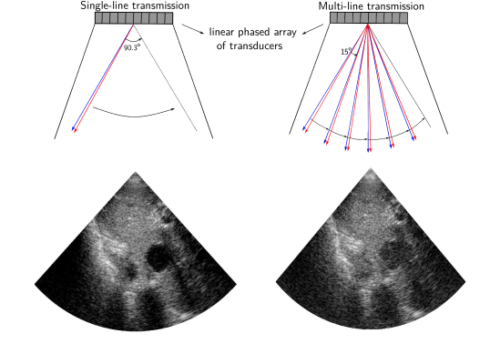 High quality ultrasonic multi-line transmission through deep learning ...
