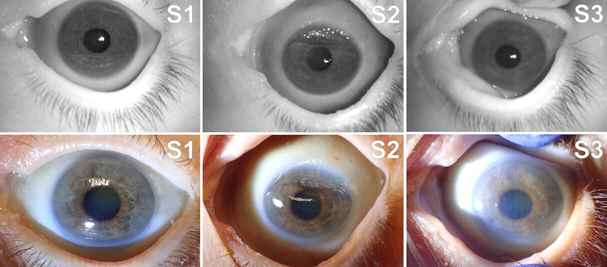 Post-mortem Human Iris Recognition | DeepAI
