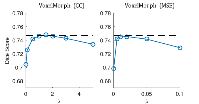 VoxelMorph: A Learning Framework for Deformable Medical Image Registration | DeepAI