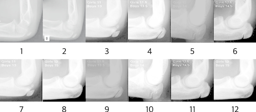 A Study on Deep Learning Based Sauvegrain Method for Measurement of ...