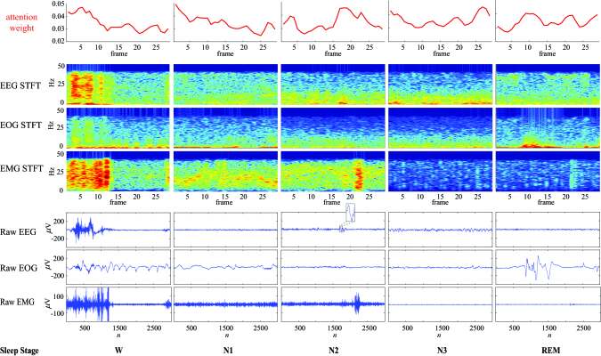 SeqSleepNet: End-to-End Hierarchical Recurrent Neural Network for Sequence-to-Sequence Automatic ...