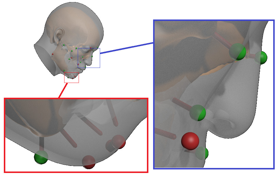 Superimposition-guided Facial Reconstruction from Skull | DeepAI
