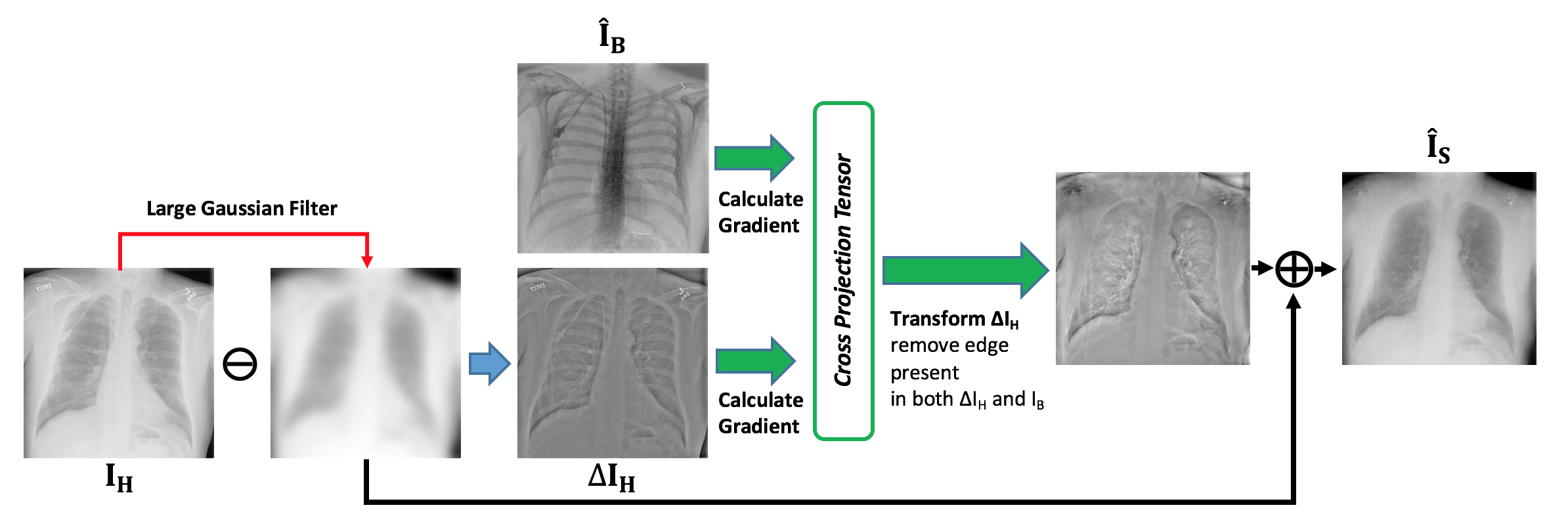 Generation of Virtual Dual Energy Images from Standard Single-Shot ...