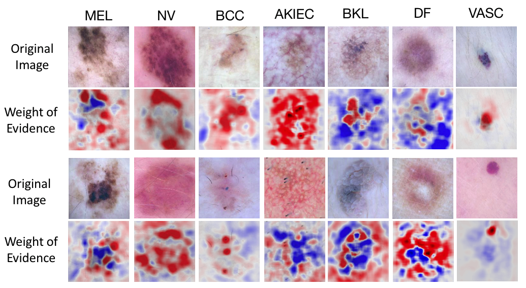 What evidence does deep learning model use to classify Skin Lesions ...