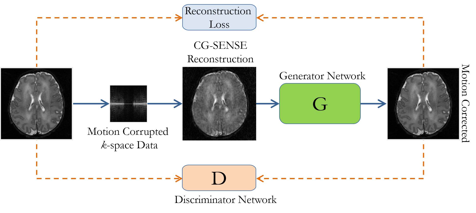 Automating Motion Correction In Multishot Mri Using Generative