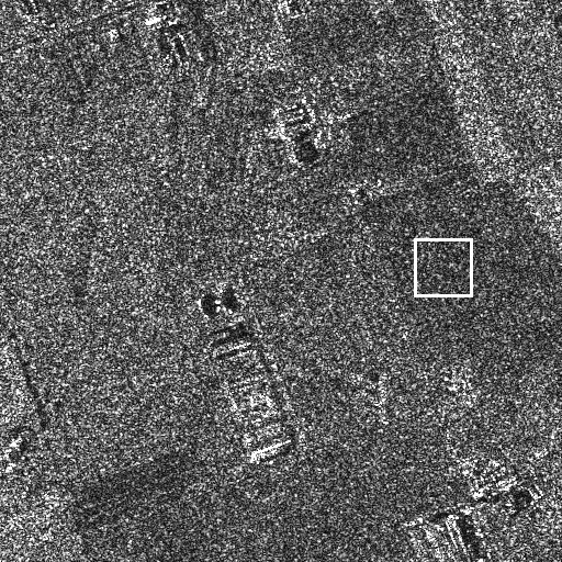 Guided Patch Wise Nonlocal Sar Despeckling Deepai